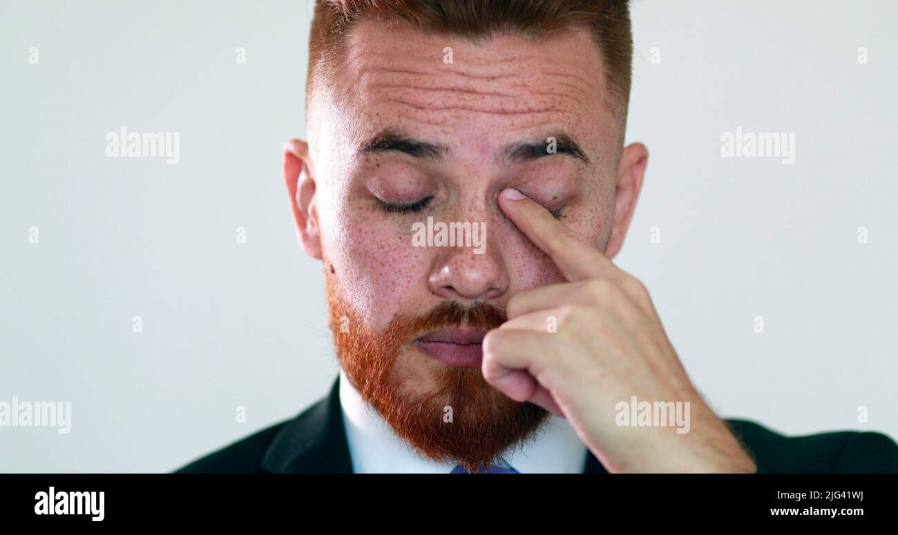 Young man scratching face with hand. Business person touching eye Stock ...