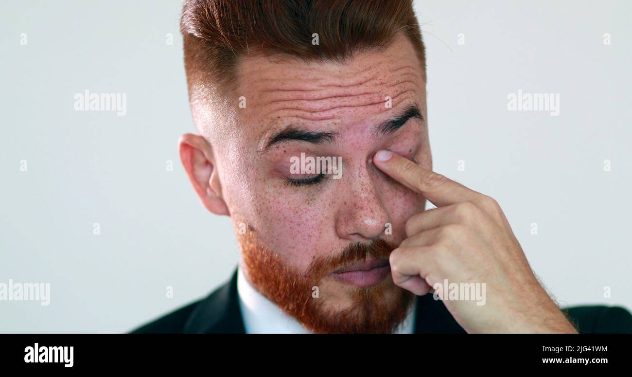 Young man scratching face with hand. Business person touching eye Stock ...