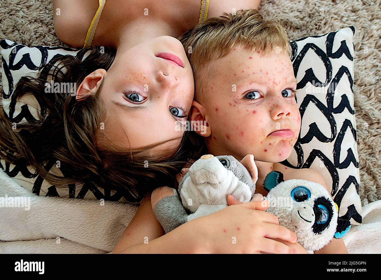 Natural vaccination. Contagious disease Stock Photo - Alamy