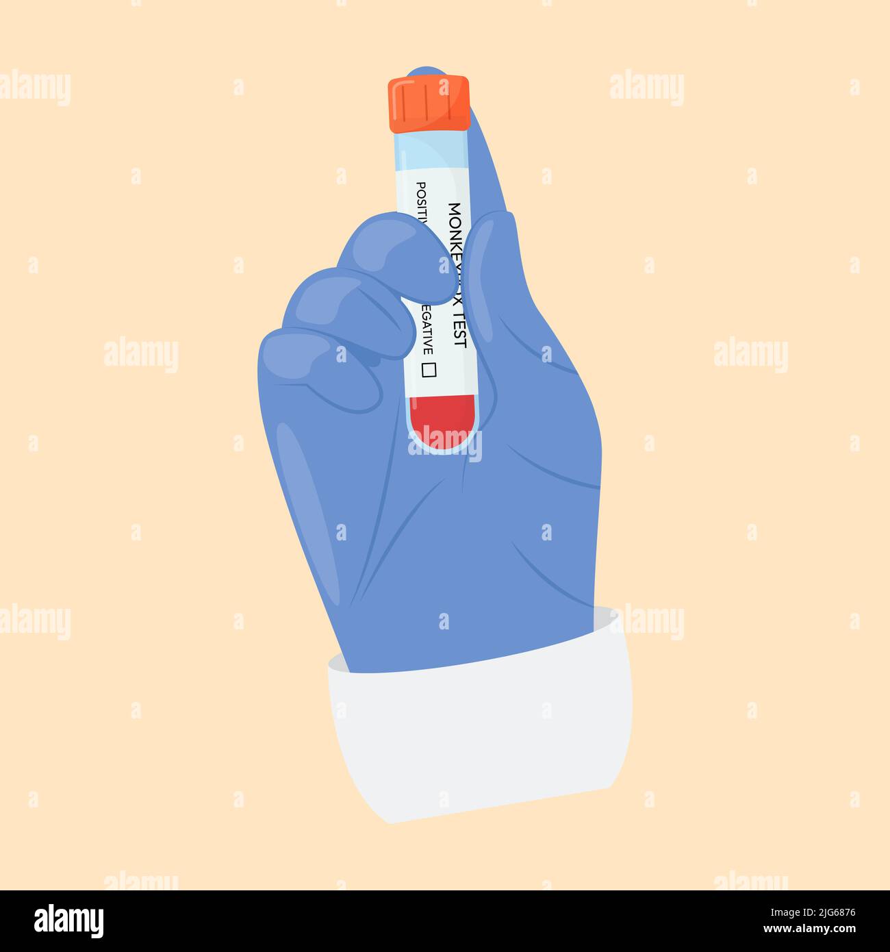 The hand of a doctor in a protective glove holds a test tube. Monkeypox ...