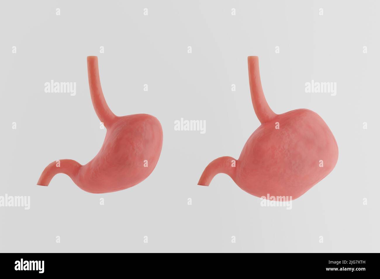 Healthy and sick stomach on a white background. Overeating, bloating ...