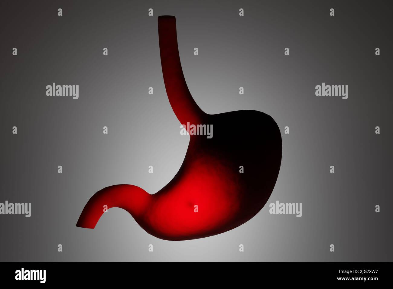Stomach with a bright area on a gray background. Problems of the ...