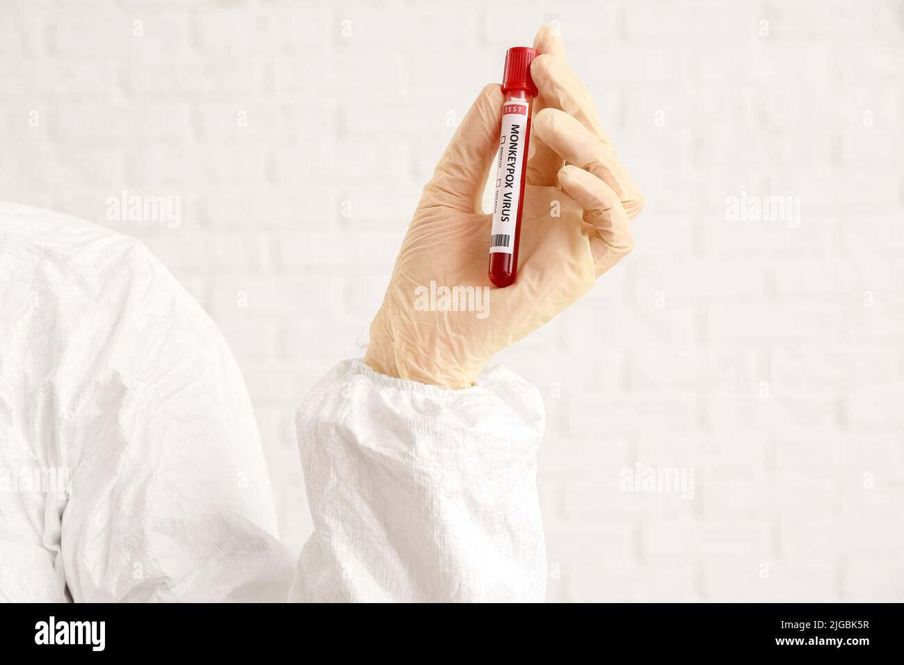 Scientist with sample of monkeypox virus on white background Stock ...