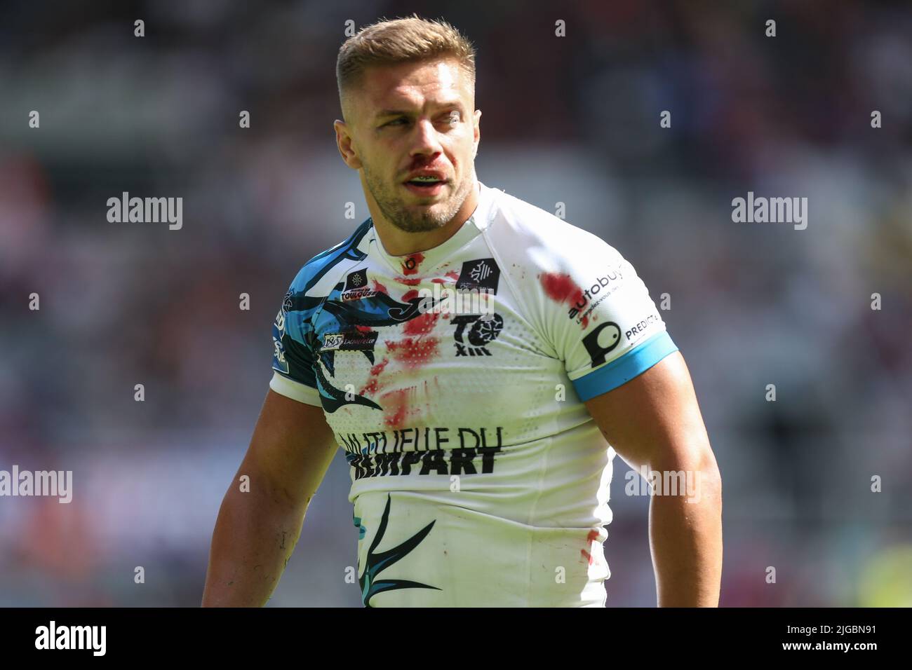 A bloodied Matty Russell #25 of Toulouse Olympique during the game in ...