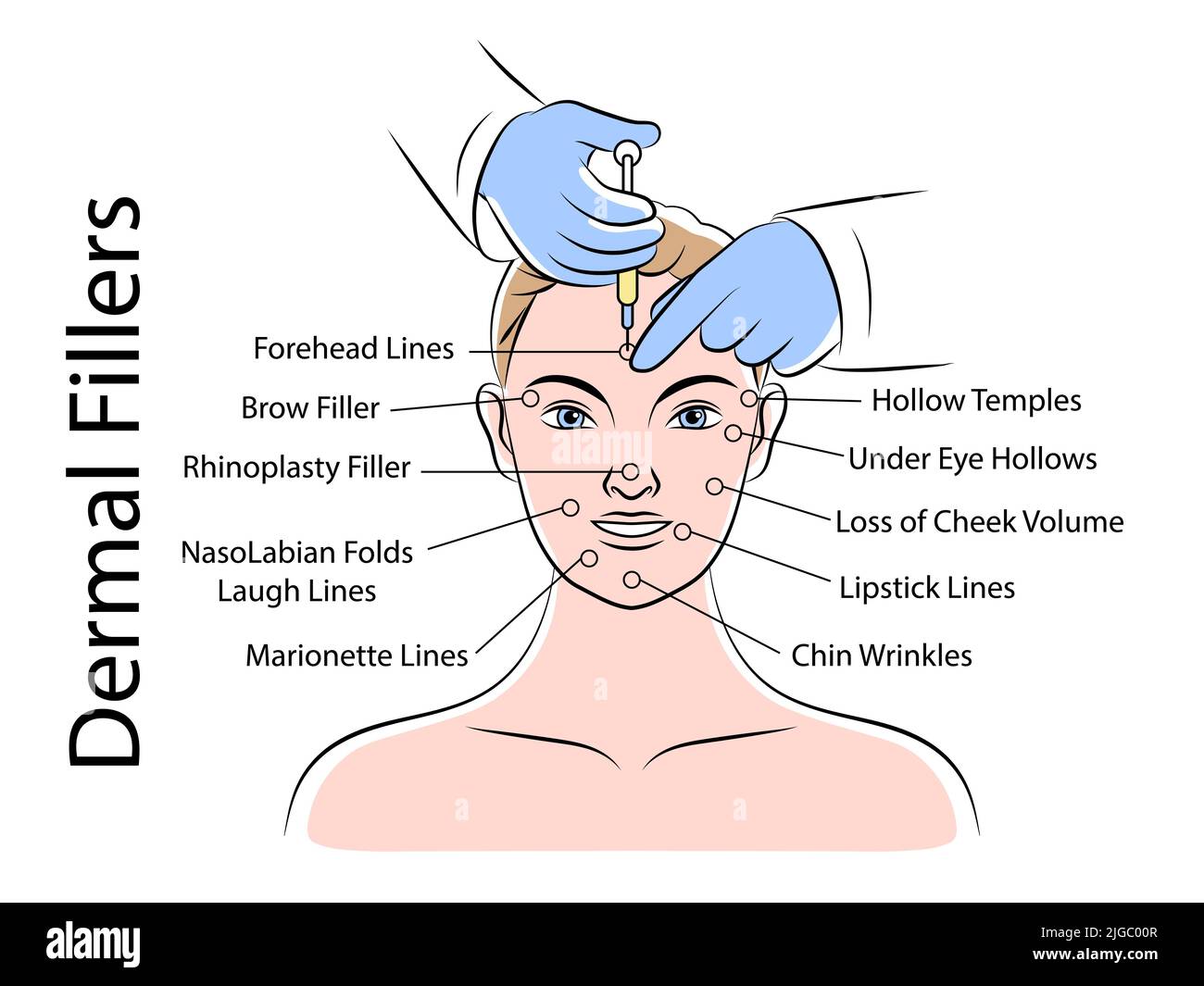 Skin care medical infographics scheme with fixing areas for dermal ...