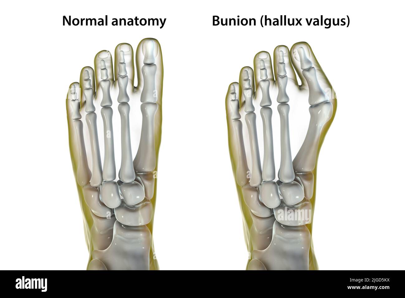 Osseous joint Cut Out Stock Images & Pictures - Alamy