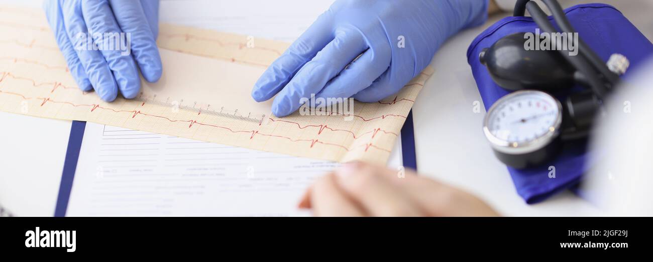 Professional cardiologist doctor examine electrogram scheme in clinic ...