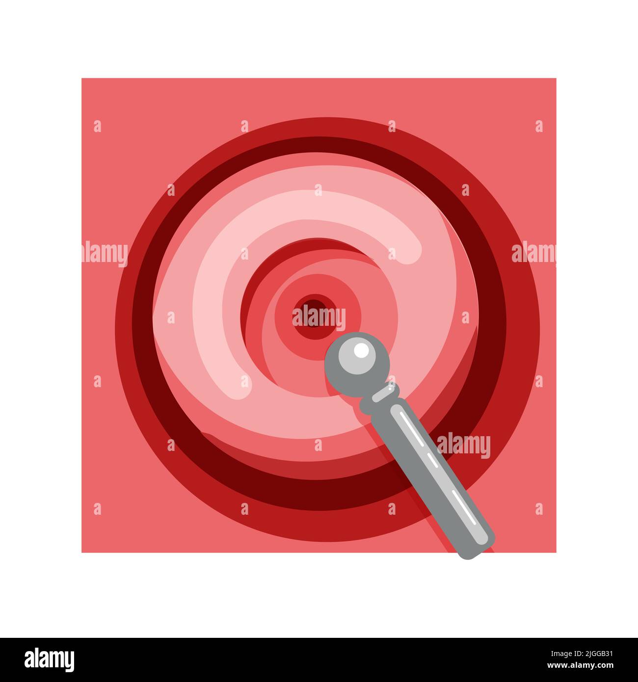 Thermal coagulation of the cervix dysplasia cancer infographic Female ...