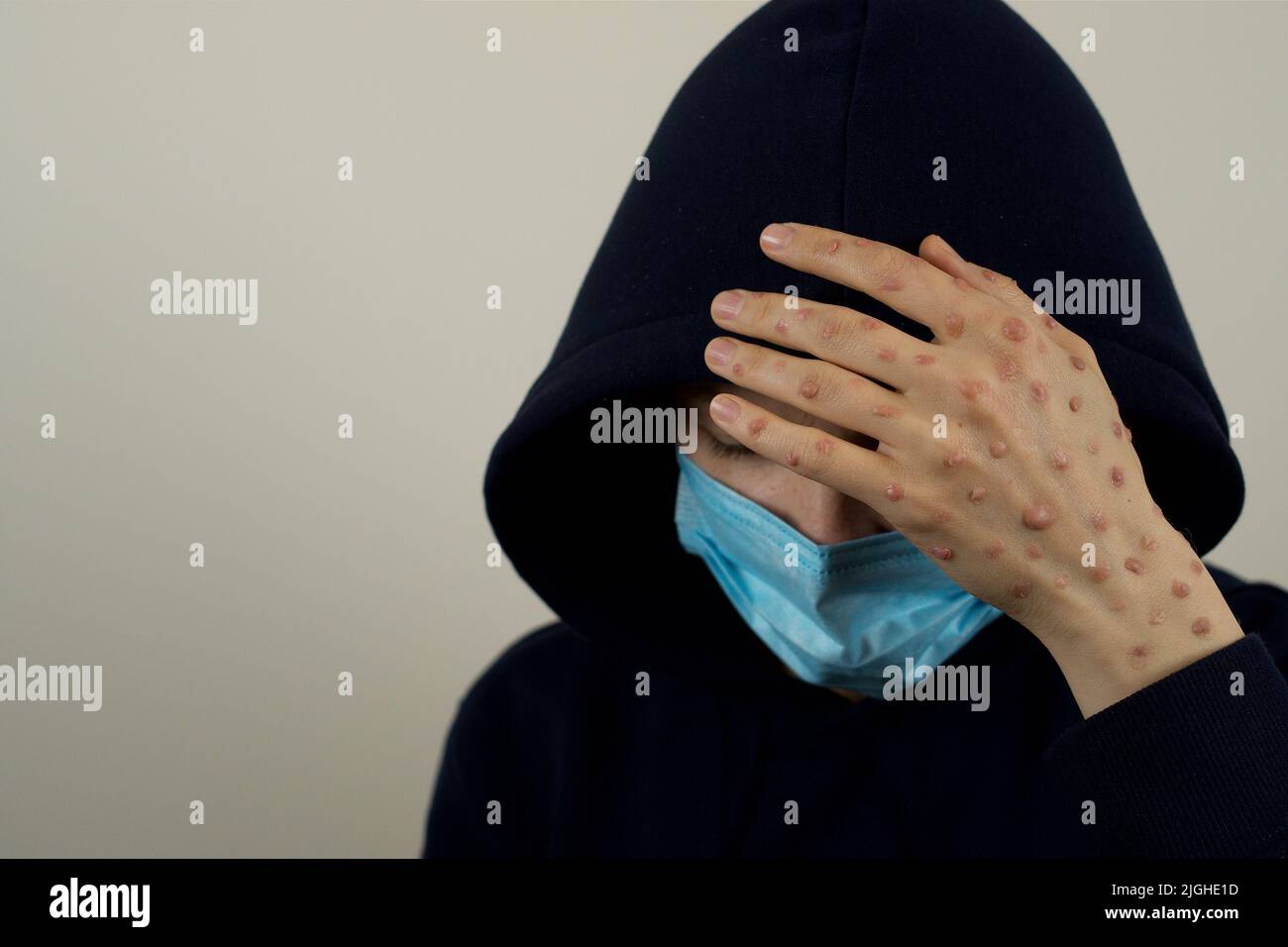 Sick woman virus symptoms hi-res stock photography and images - Alamy