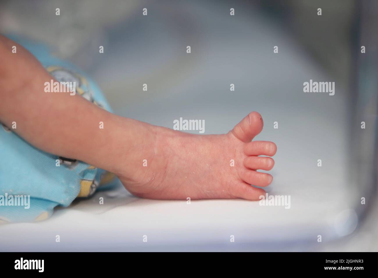 Little foot of a newborn baby. Neonatal medicine Stock Photo - Alamy