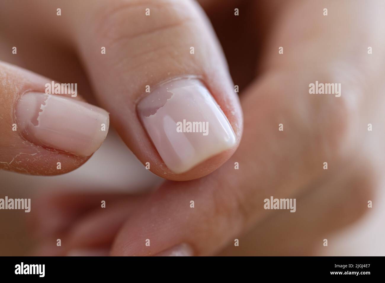 Woman chipped nail polish hi-res stock photography and images - Alamy