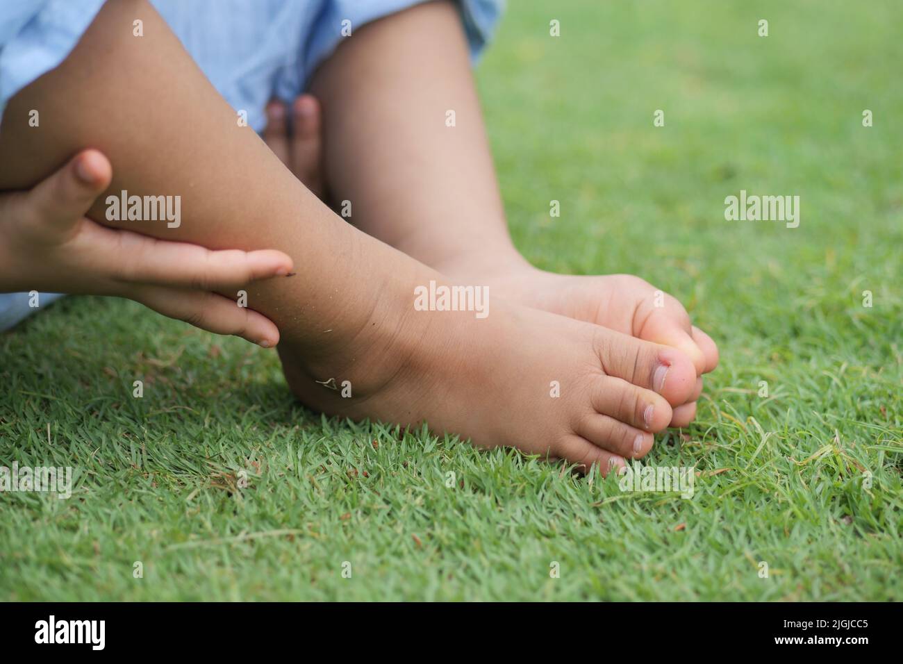 child girl suffering from itching skin, close up Stock Photo - Alamy