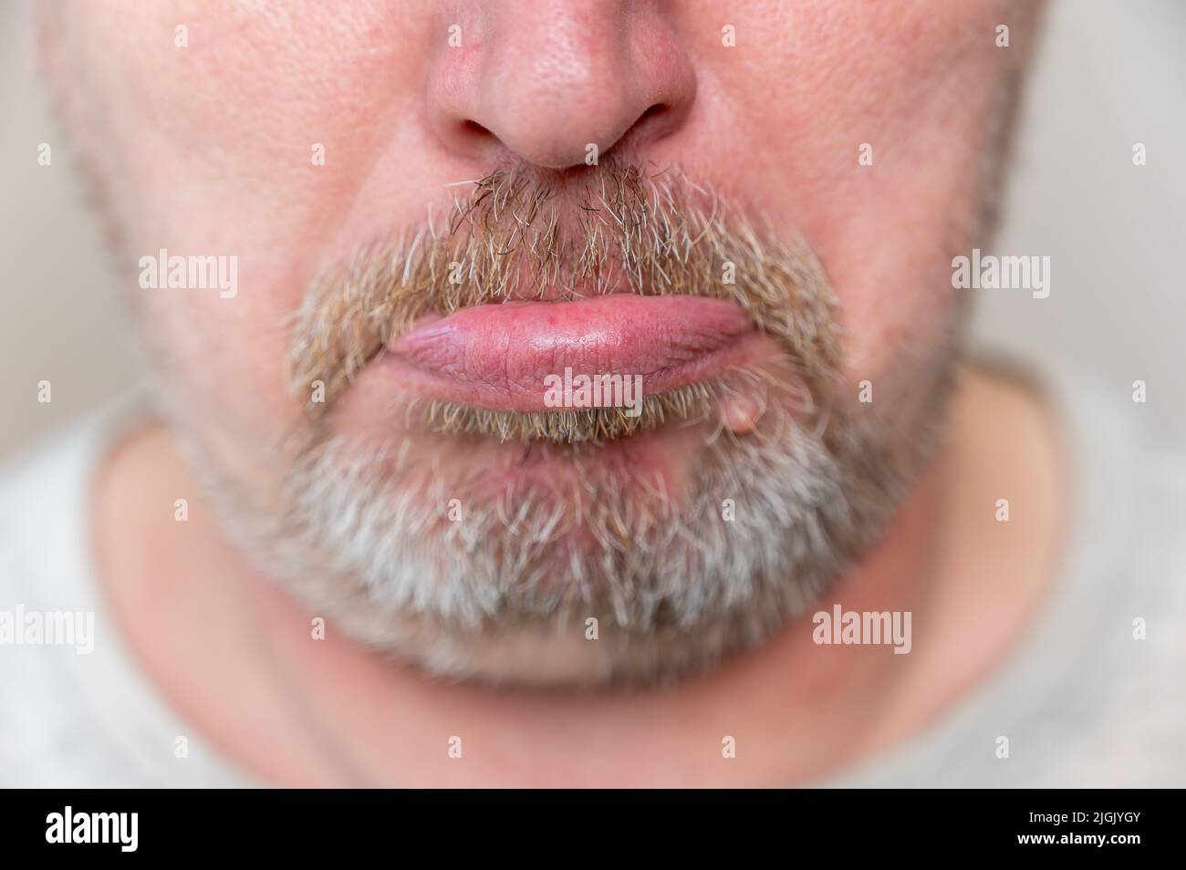 A mature man is crooked. The lower part of the male face. Man has his ...