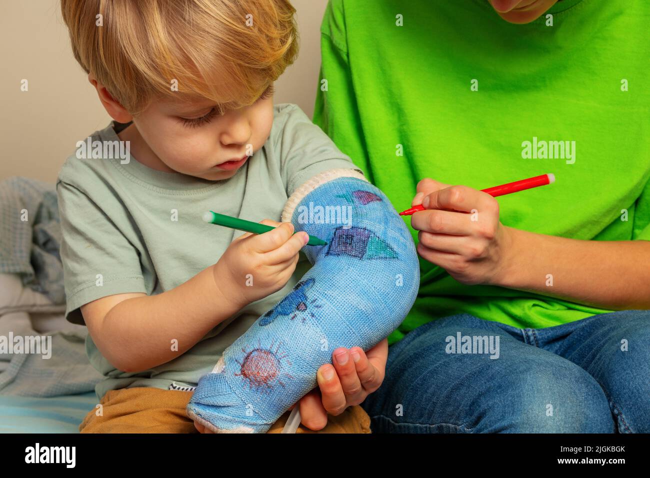Boy and brother draw broken hand plaster cast using felt-tip pen Stock ...