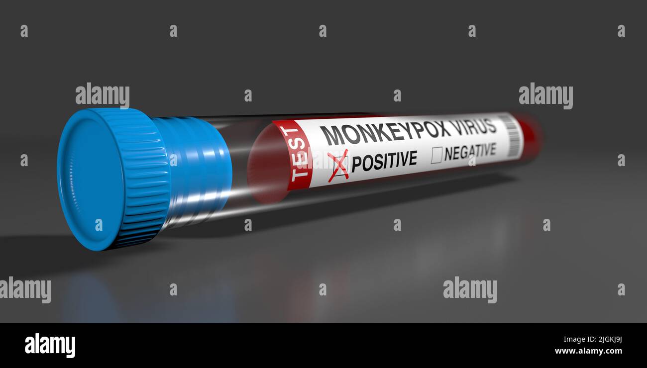 Glass test tube with blood sample positive for monkeypox on shiny gray ...