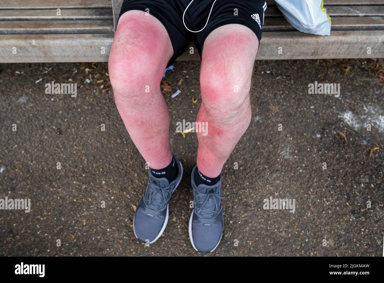 Sunbather legs hi-res stock photography and images - Alamy