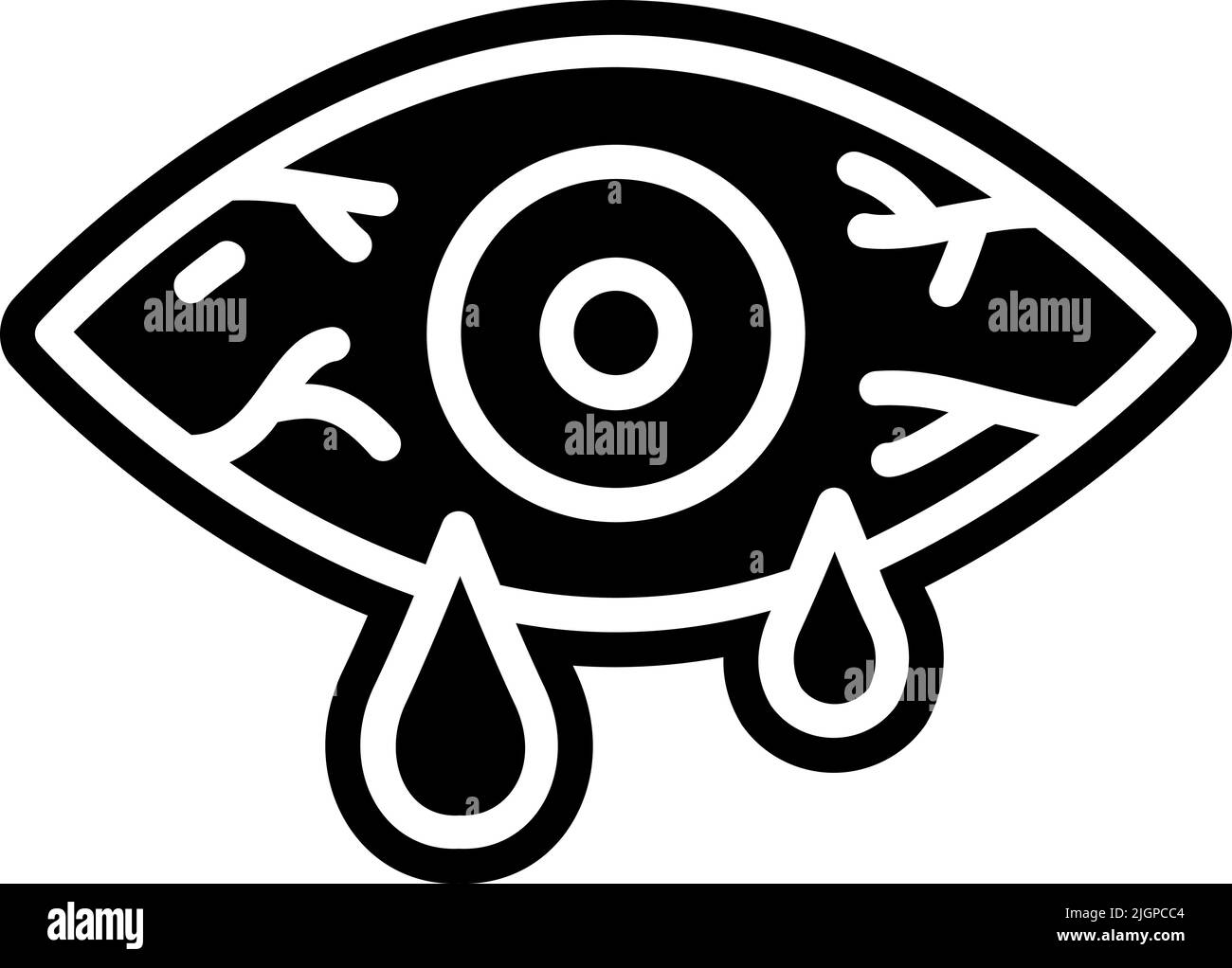 Eye diseases vision Stock Vector Images - Alamy