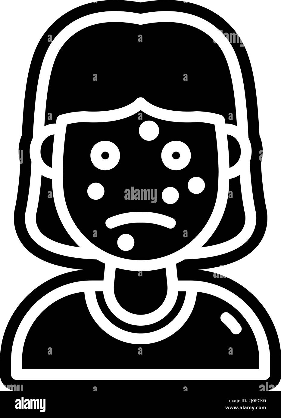 Acne scar treatment Stock Vector Images - Alamy