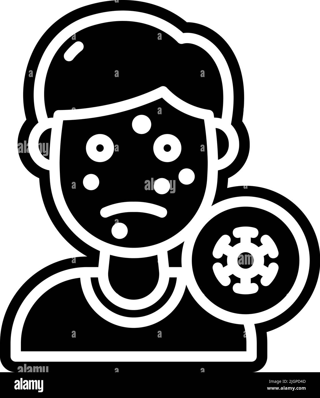 Diseases smallpox icon Stock Vector Image & Art - Alamy