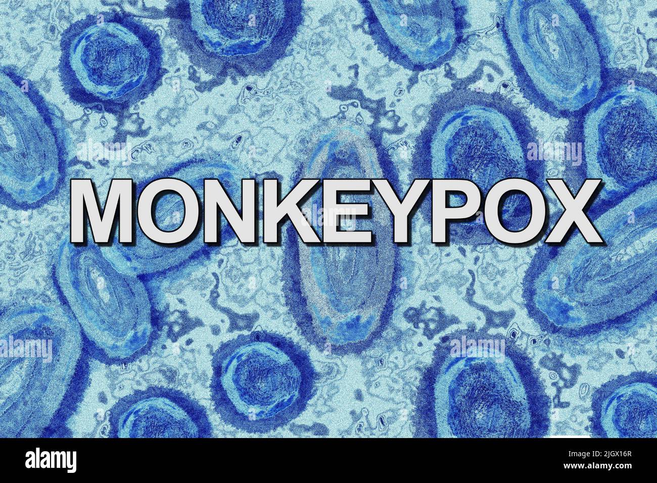 Smallpox virus microscope hi-res stock photography and images - Alamy