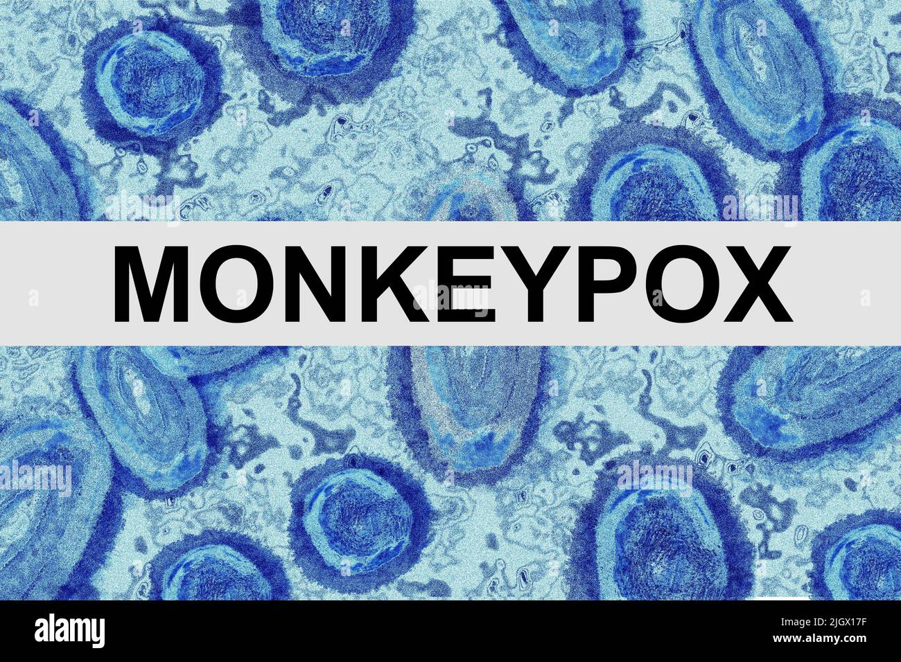 Monkeypox under microscope hi-res stock photography and images - Alamy