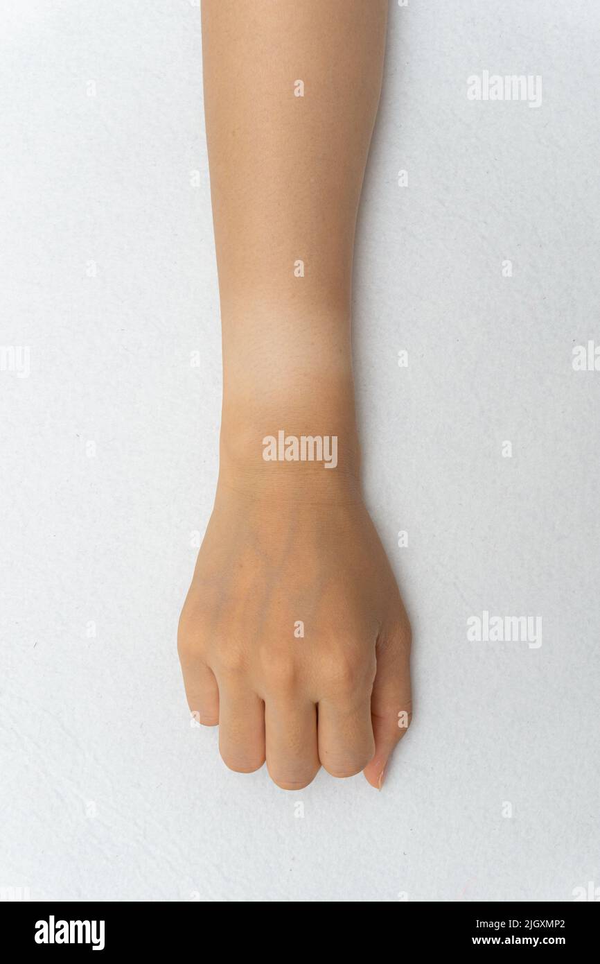 Watch marks on a woman's hand burned in the sun Stock Photo - Alamy