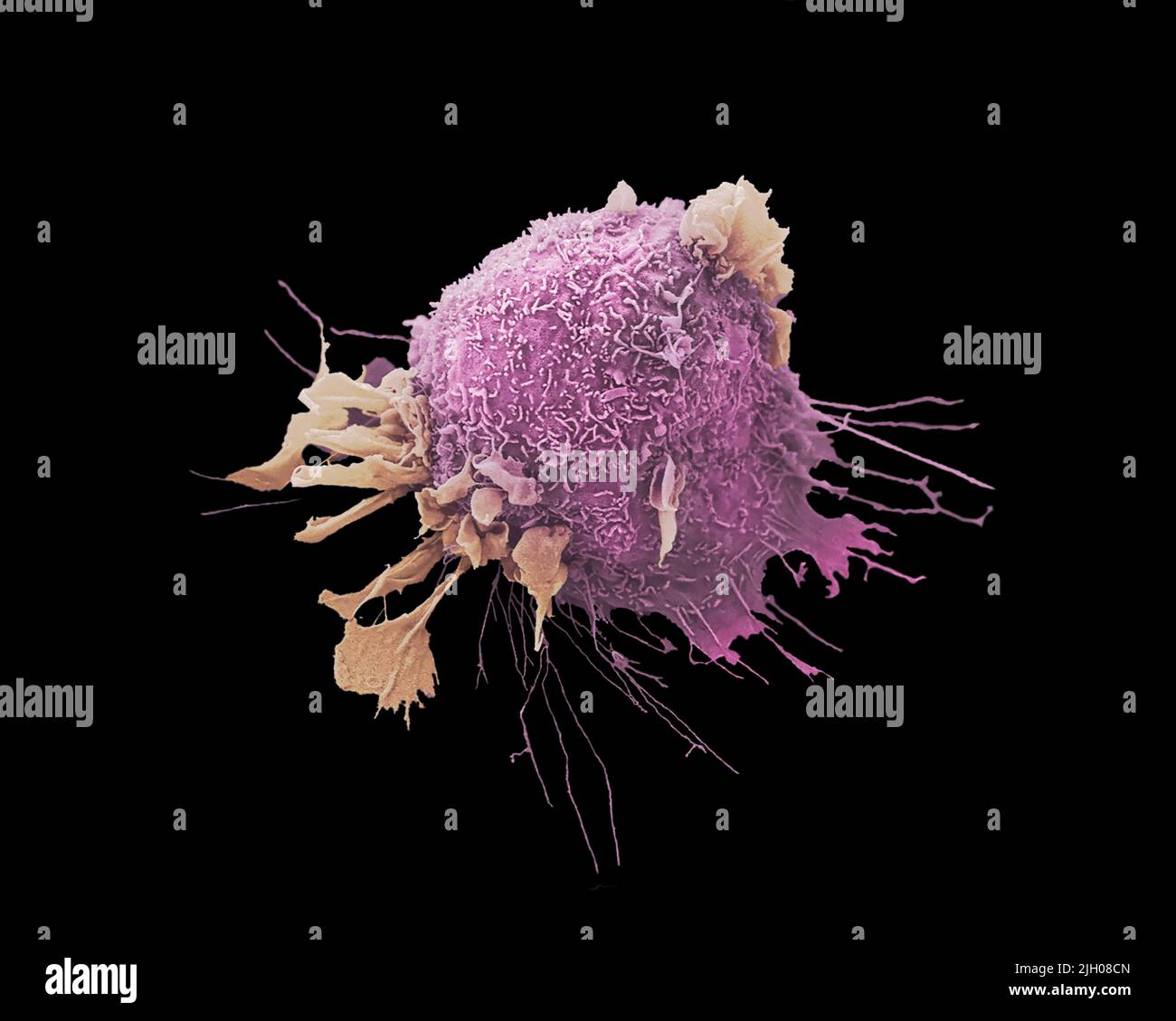 Lung cancer cell, SEM Stock Photo - Alamy
