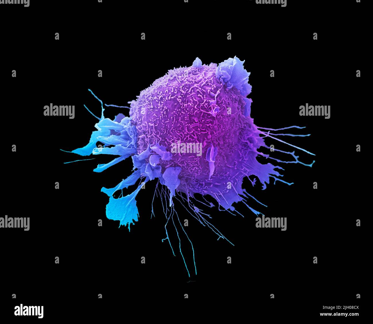 Lung cancer cell, SEM Stock Photo - Alamy