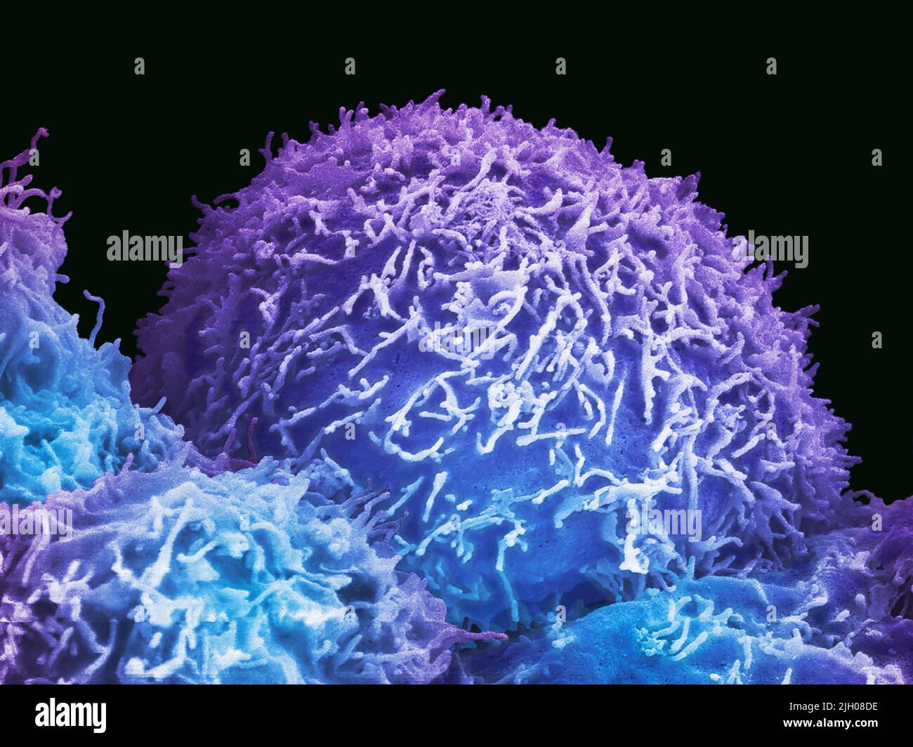 Prostate cancer cells, SEM Stock Photo - Alamy