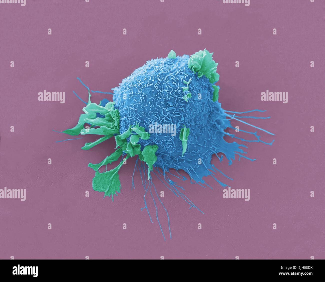 Lung cancer cell, SEM Stock Photo - Alamy