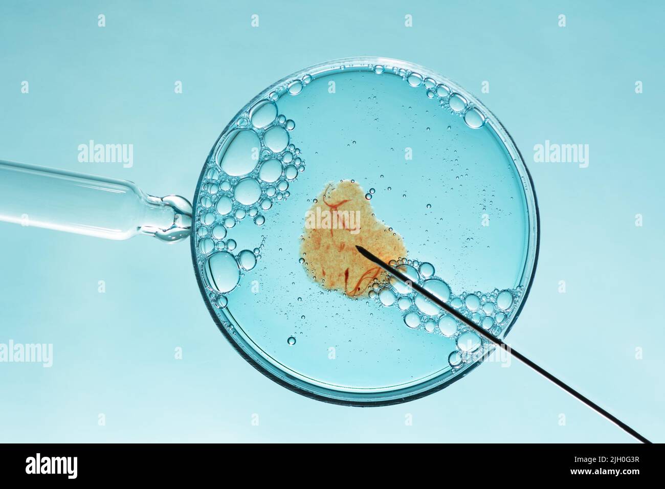 In vitro fertilisation concept. Artificial insemination or fertility ...