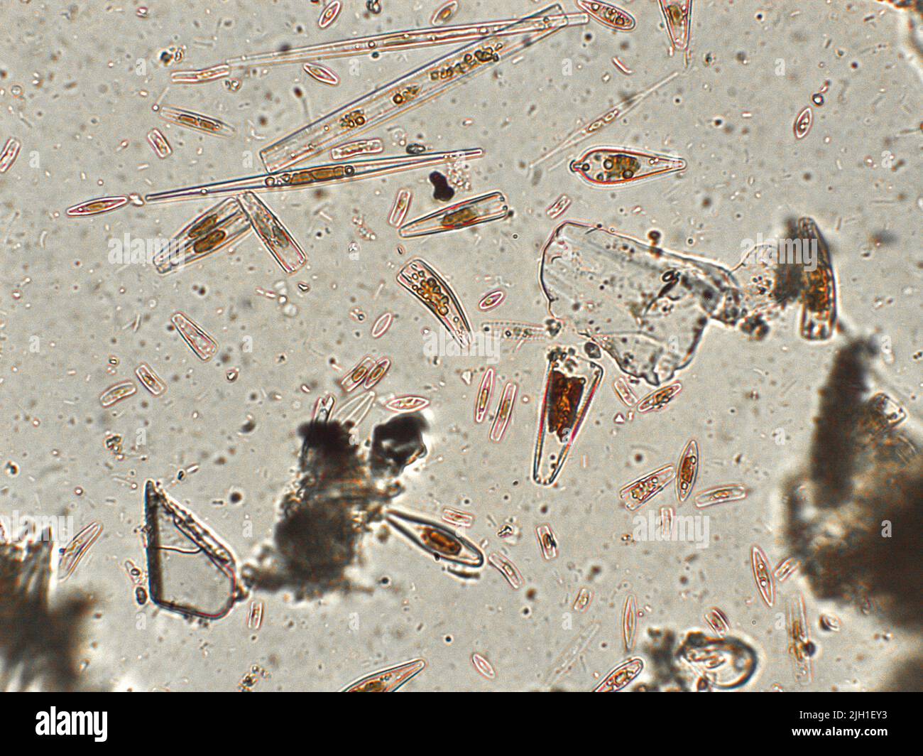 Diatoms under microscopic view Stock Photo - Alamy