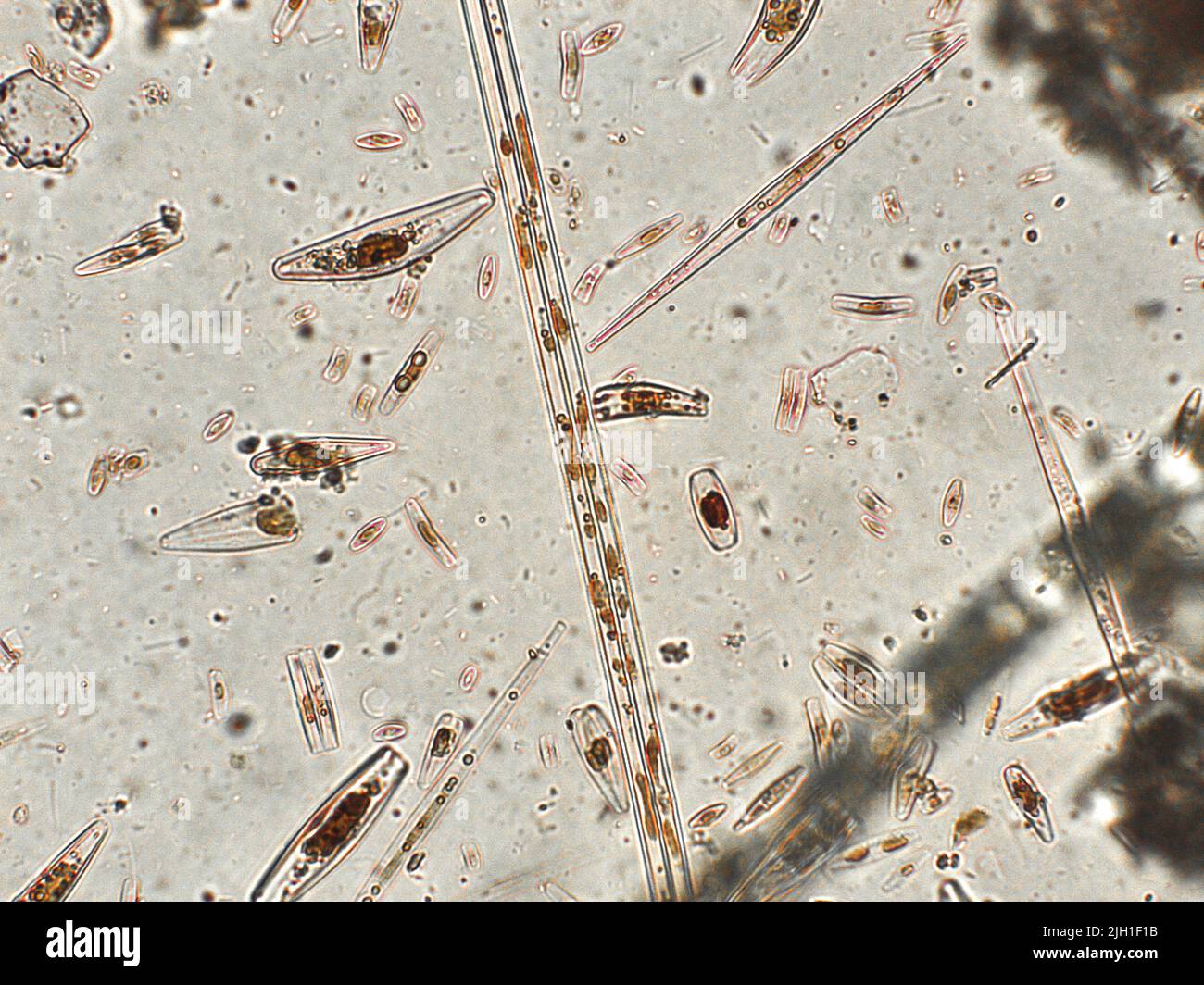 Diatoms under microscopic view Stock Photo - Alamy
