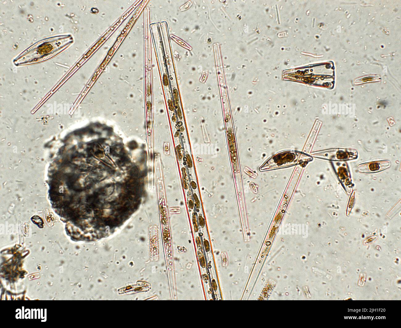 Diatoms under microscopic view Stock Photo - Alamy