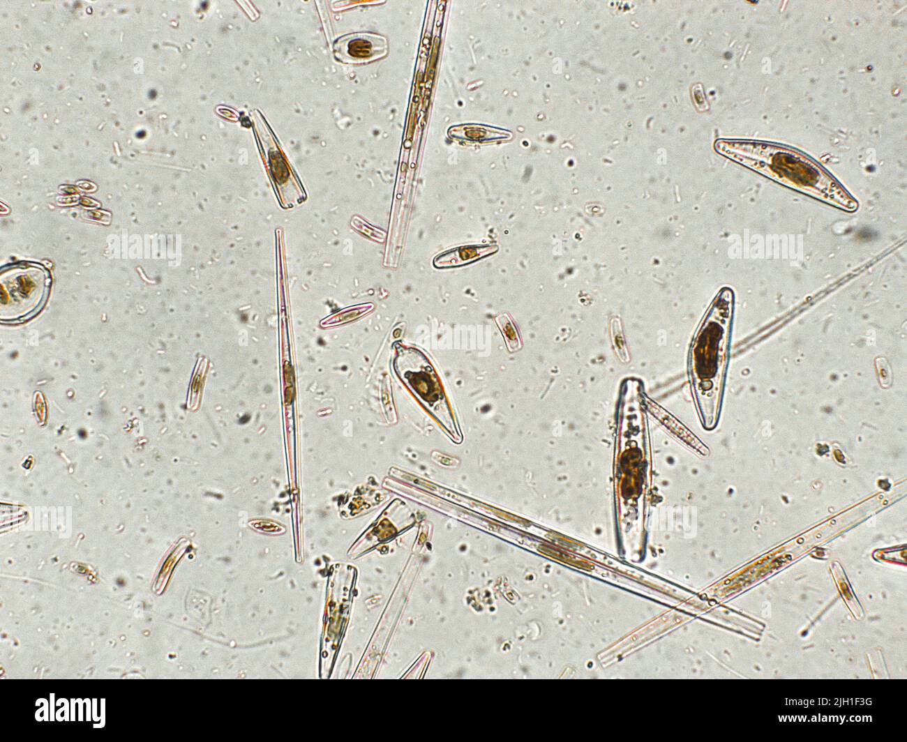 Diatoms under microscopic view Stock Photo - Alamy