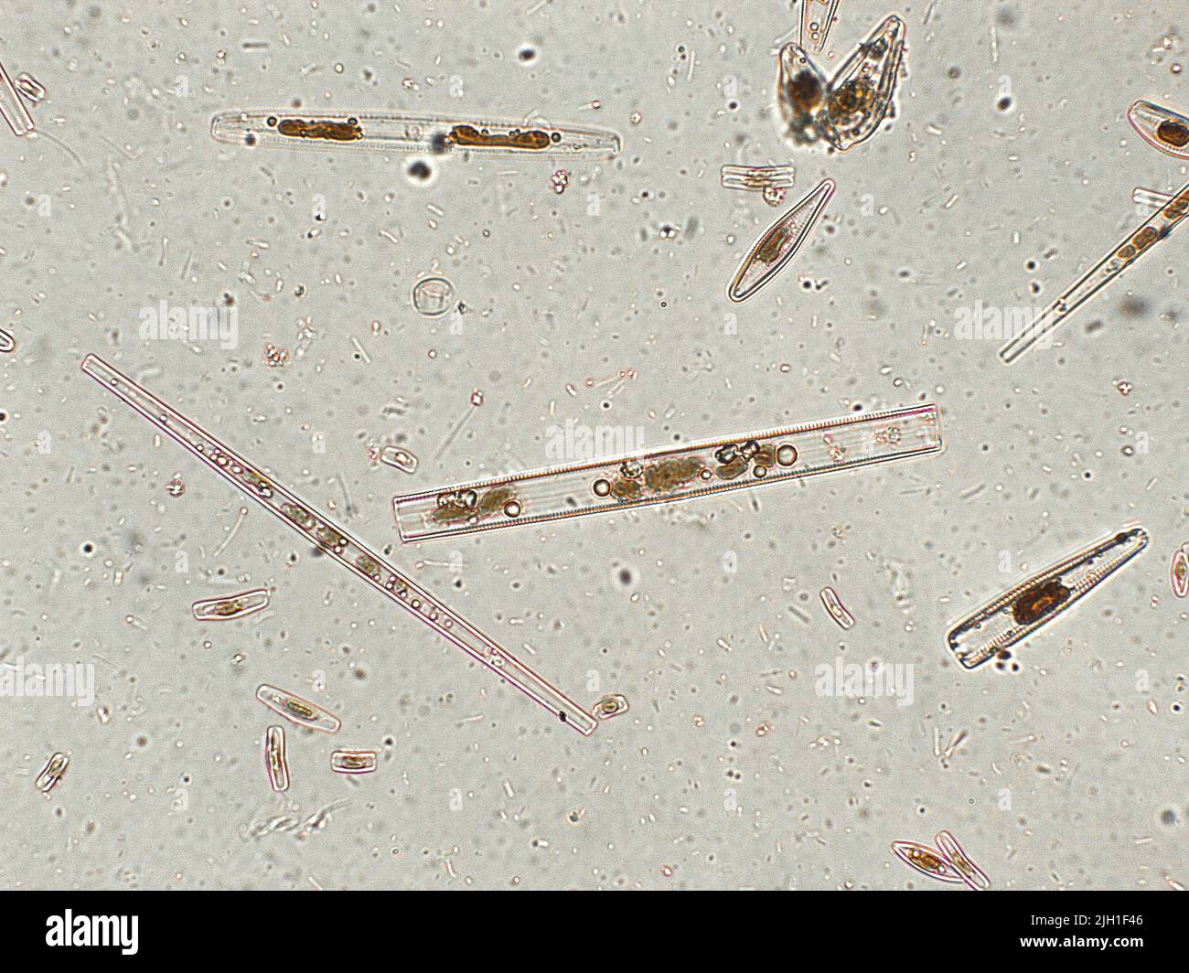 Diatoms under microscopic view Stock Photo - Alamy