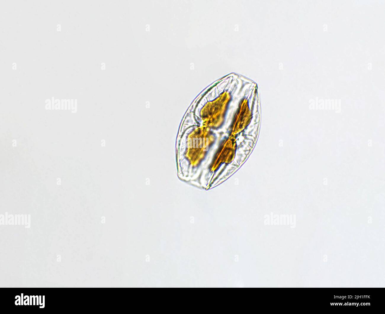 Amphora sp. algae under microscopic view, Diatoms, phytoplankton ...