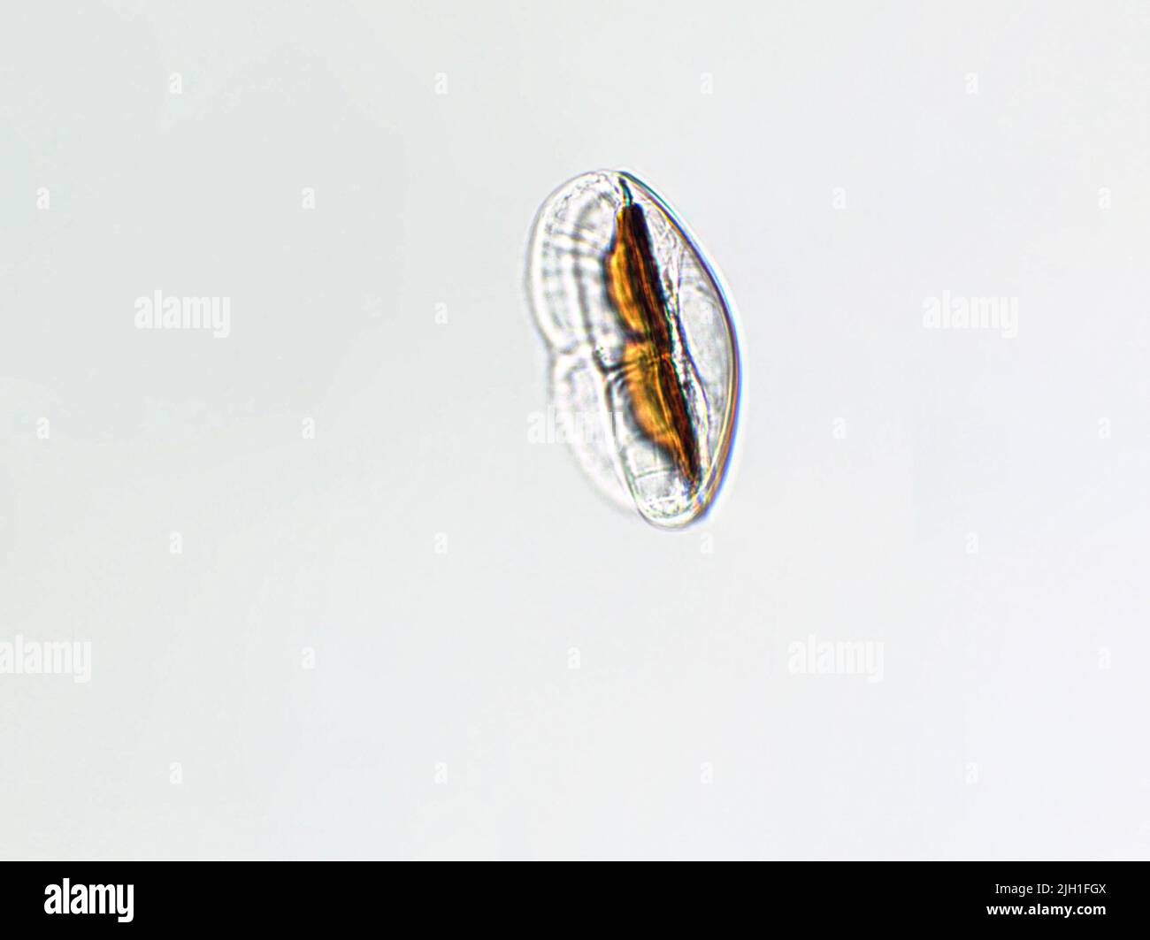 Amphora sp. algae under microscopic view, Diatoms, phytoplankton ...