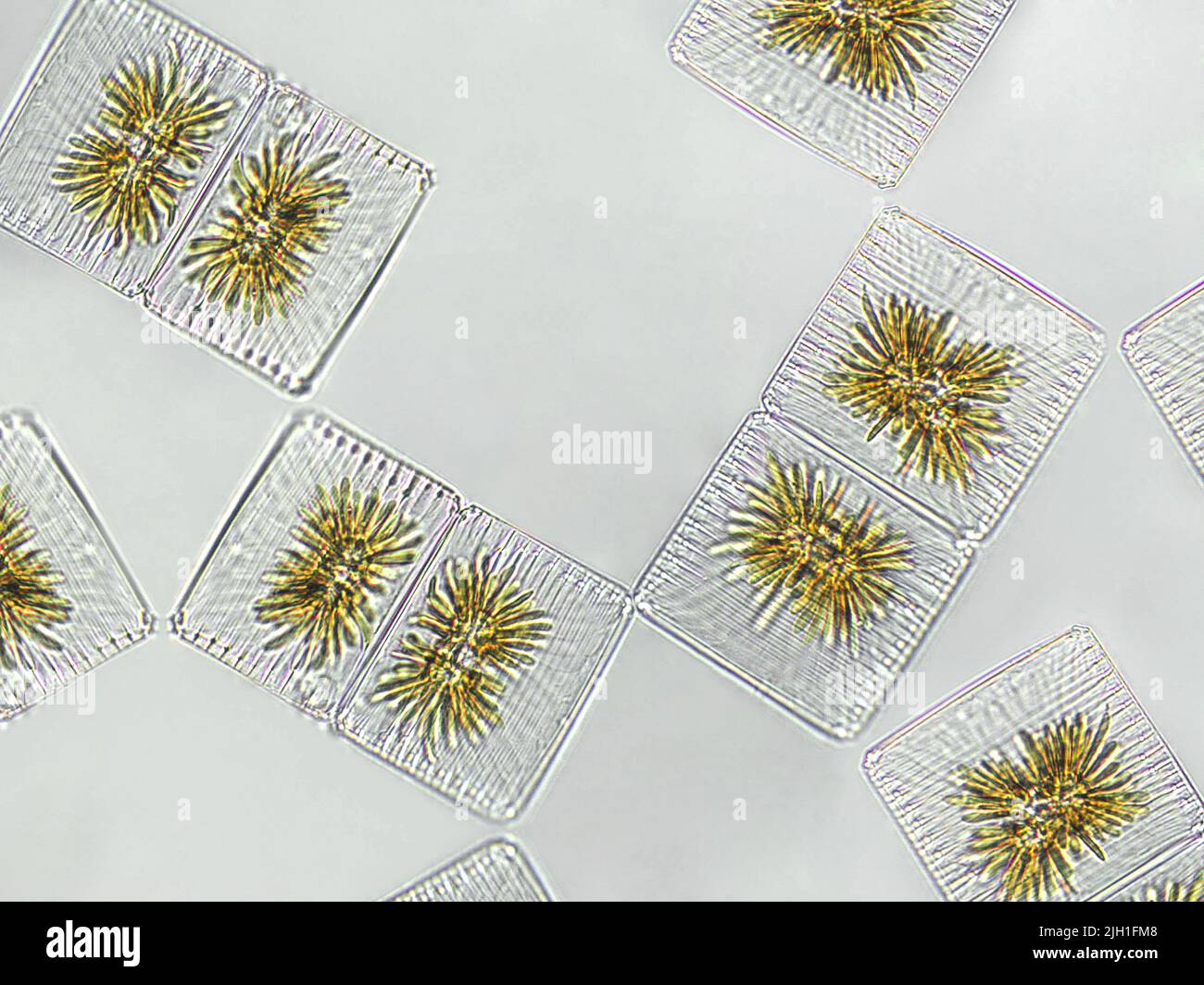 Striatella unipunctata algae under microscopic view, phytoplankton ...