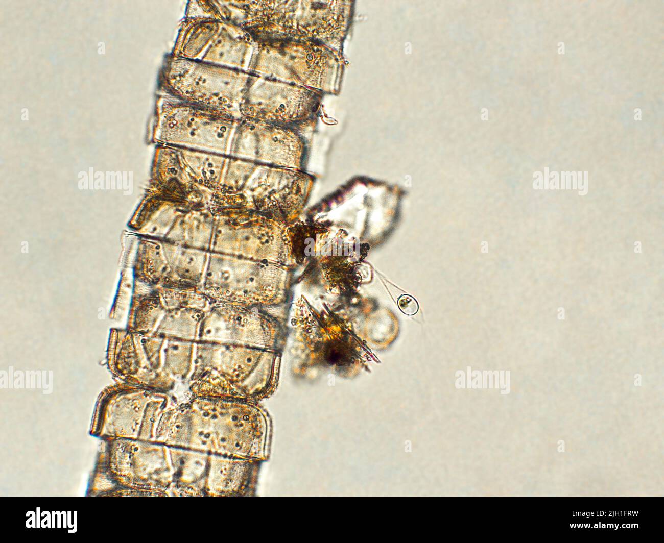 Algae with zooplankton under microscopic view Stock Photo - Alamy