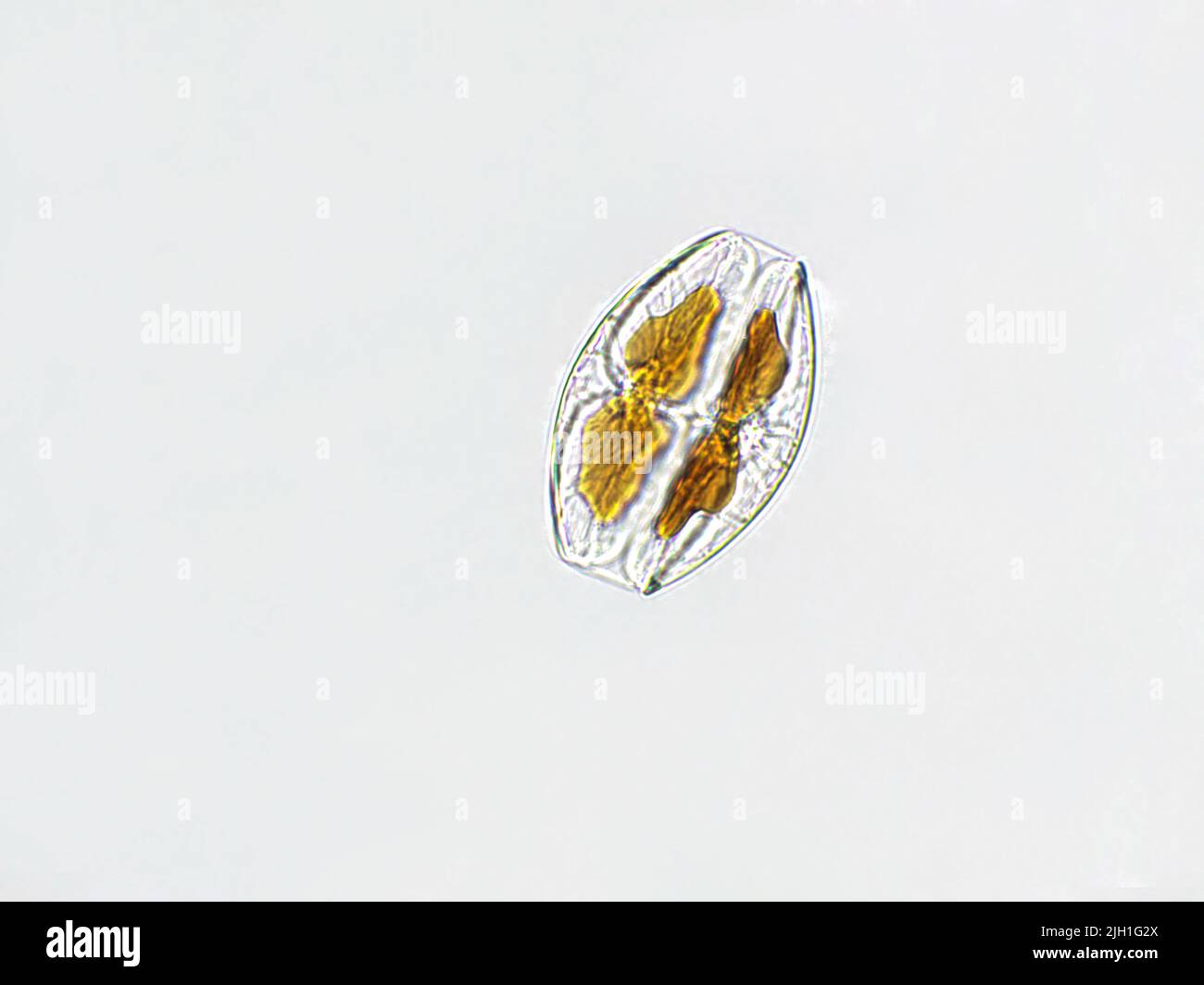 Amphora sp. algae under microscopic view, Diatoms, phytoplankton ...