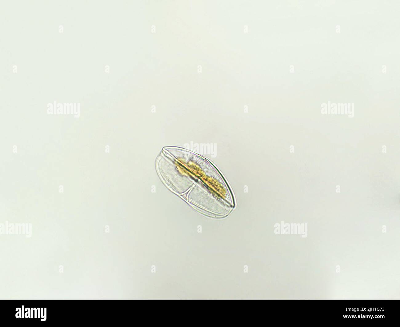 Amphora sp. algae under microscopic view, Diatoms, phytoplankton ...