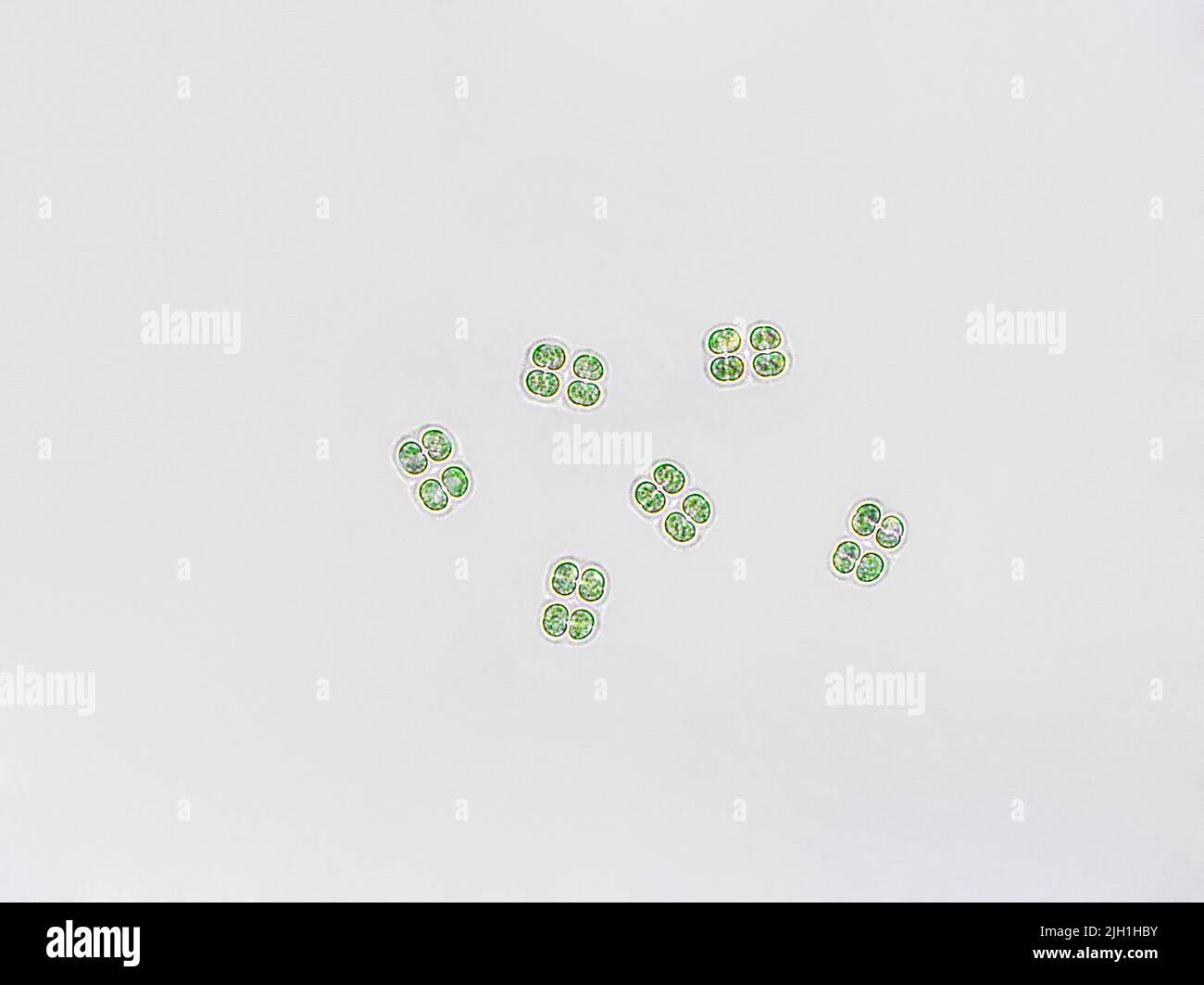 Chroococcus sp. algae under microscopic view, cyanobacteria Stock Photo ...