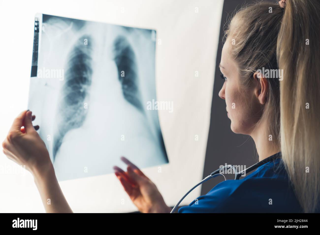 Doctor chest xray hi-res stock photography and images - Alamy