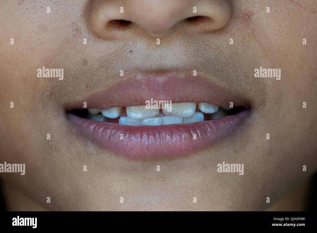 baby smile close. white teeth of a child isolated on a white background ...
