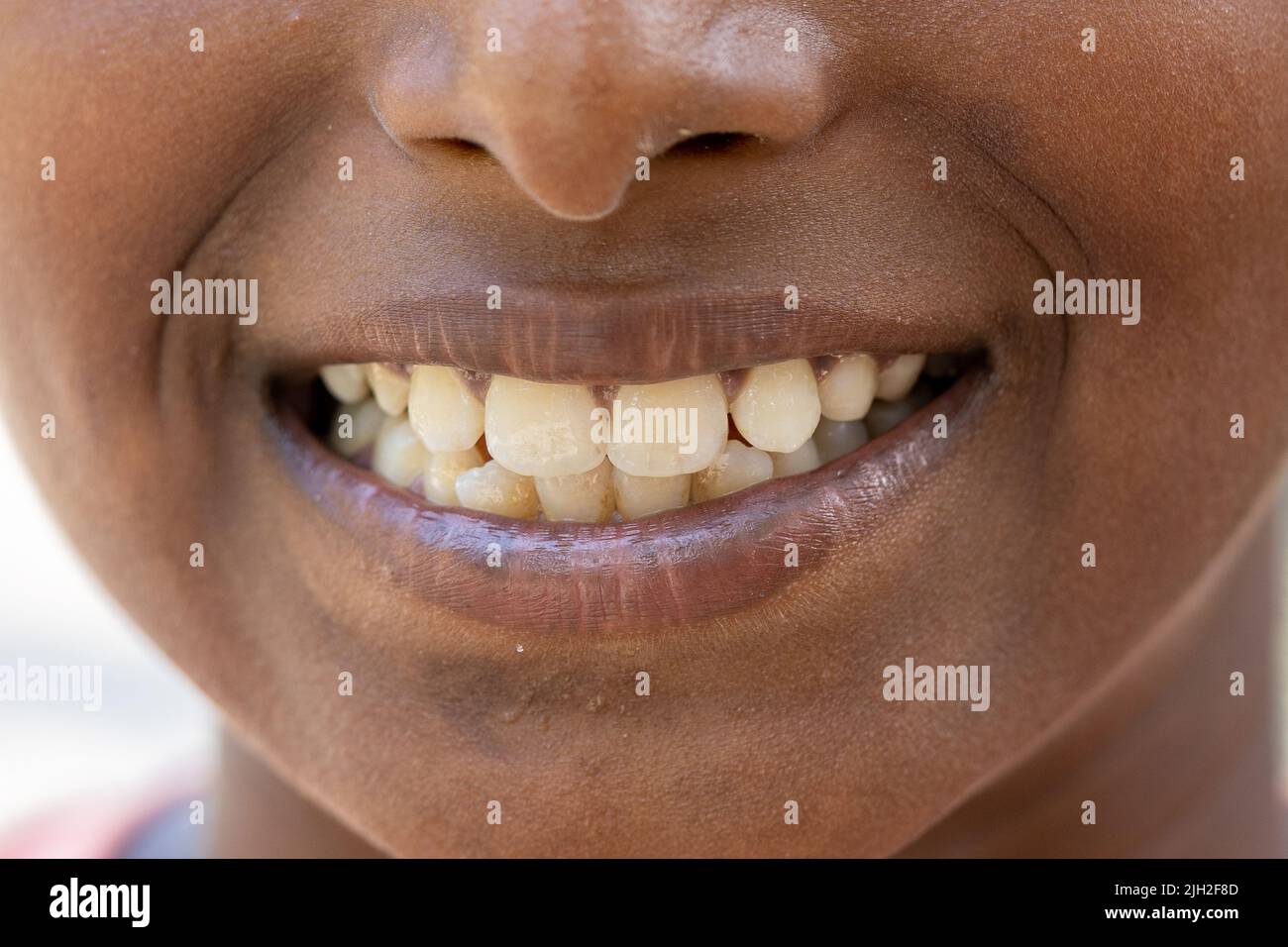 baby smile close. white teeth of a child isolated on a white background ...