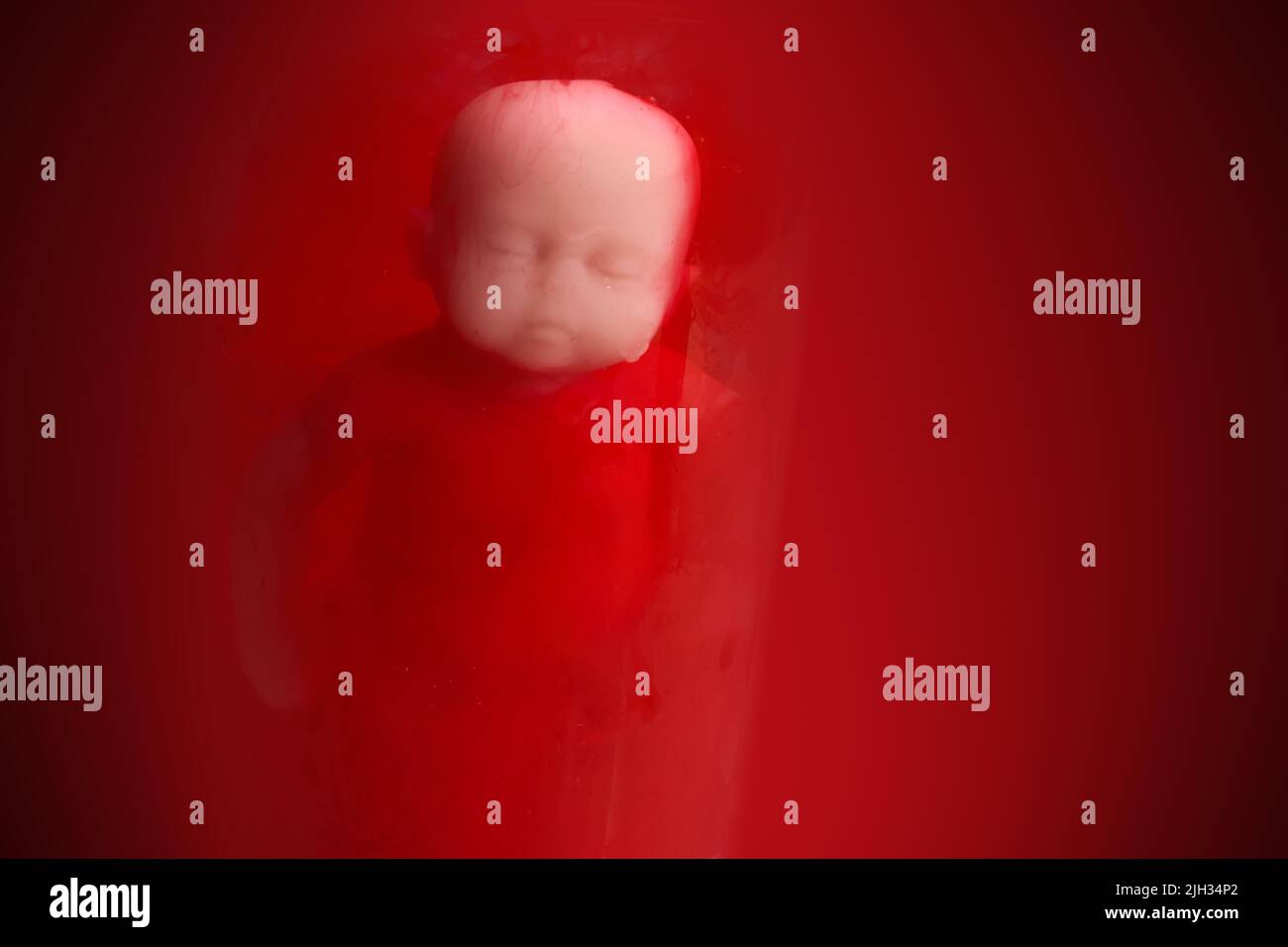 Abortation law hi-res stock photography and images - Alamy