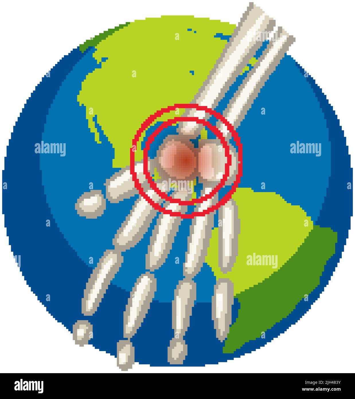 Hand bone joint on earth planet background illustration Stock Vector ...