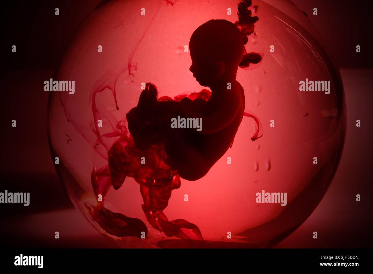 Abortation law hi-res stock photography and images - Alamy