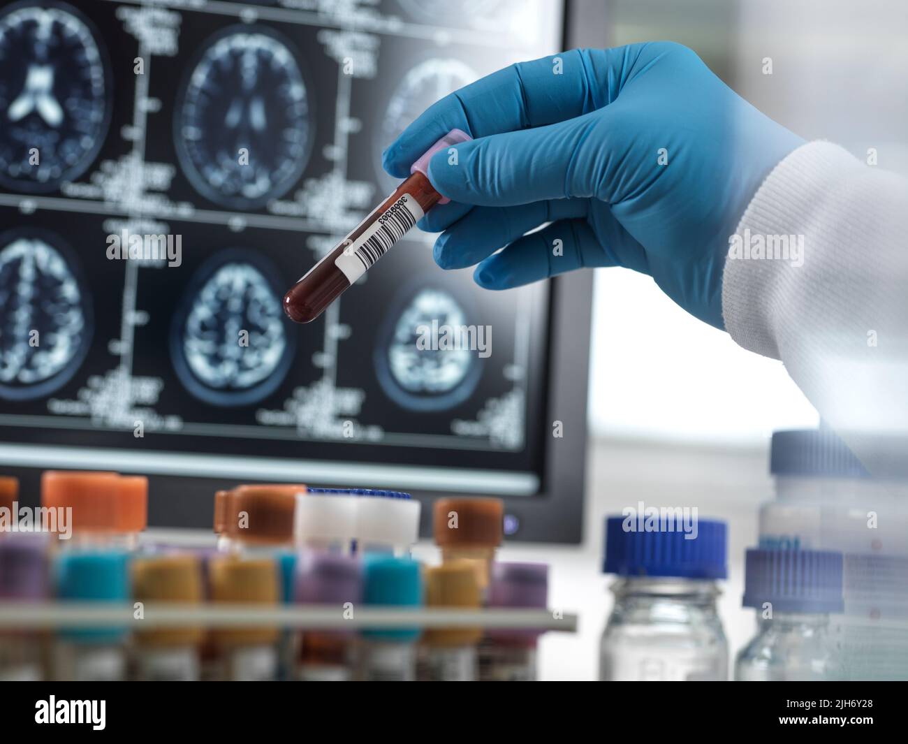 Alzheimer's and dementia research, conceptual image Stock Photo - Alamy